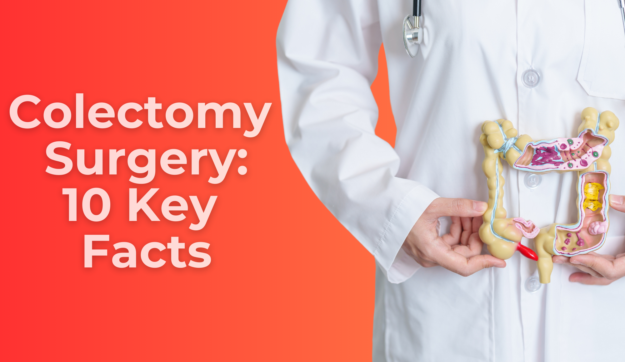 10 Essential Things to Know About Colectomy Surgery in Cebu City – Cebu ...
